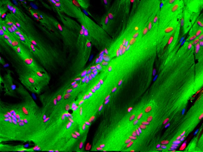 Human Differentiated Myotubes | NIAMS