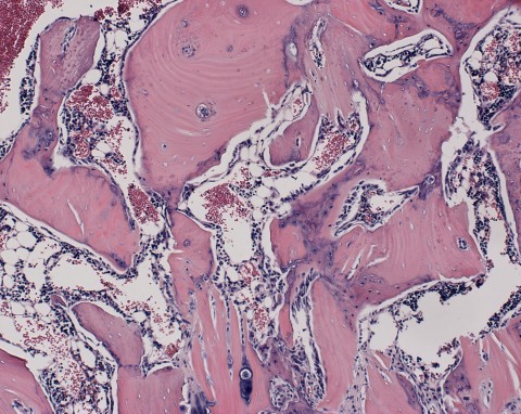Bone formation in rat spine | NIAMS